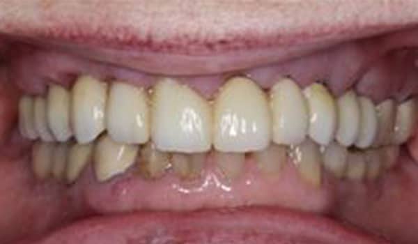 South Island Periodontics & Implantology | Cedarhurst, NY