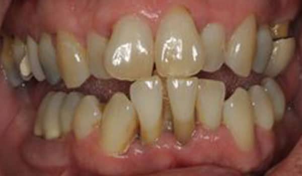 South Island Periodontics & Implantology | Cedarhurst, NY