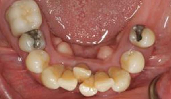 South Island Periodontics & Implantology | Cedarhurst, NY