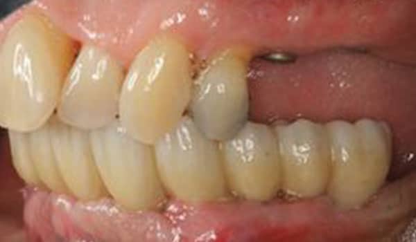 South Island Periodontics & Implantology | Cedarhurst, NY