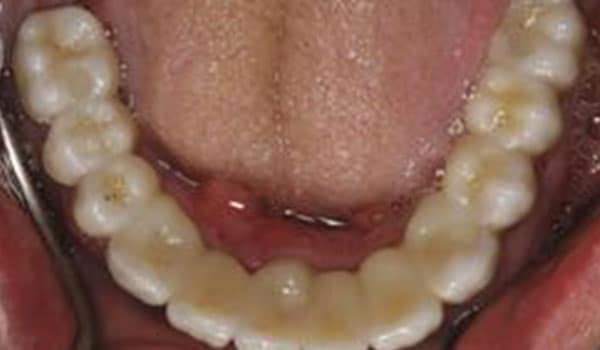 South Island Periodontics & Implantology | Cedarhurst, NY